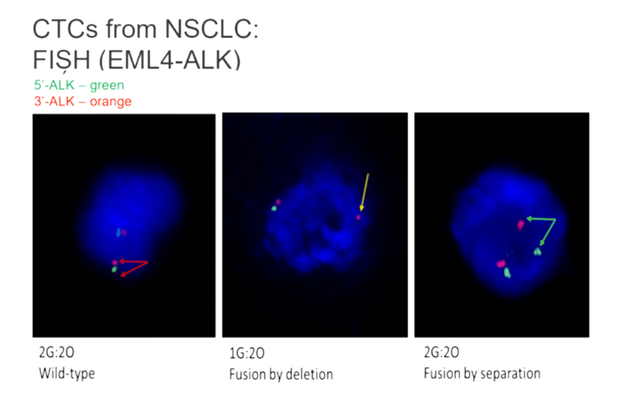 Fluorescence In Situ Hybridization Services | Precision for Medicine